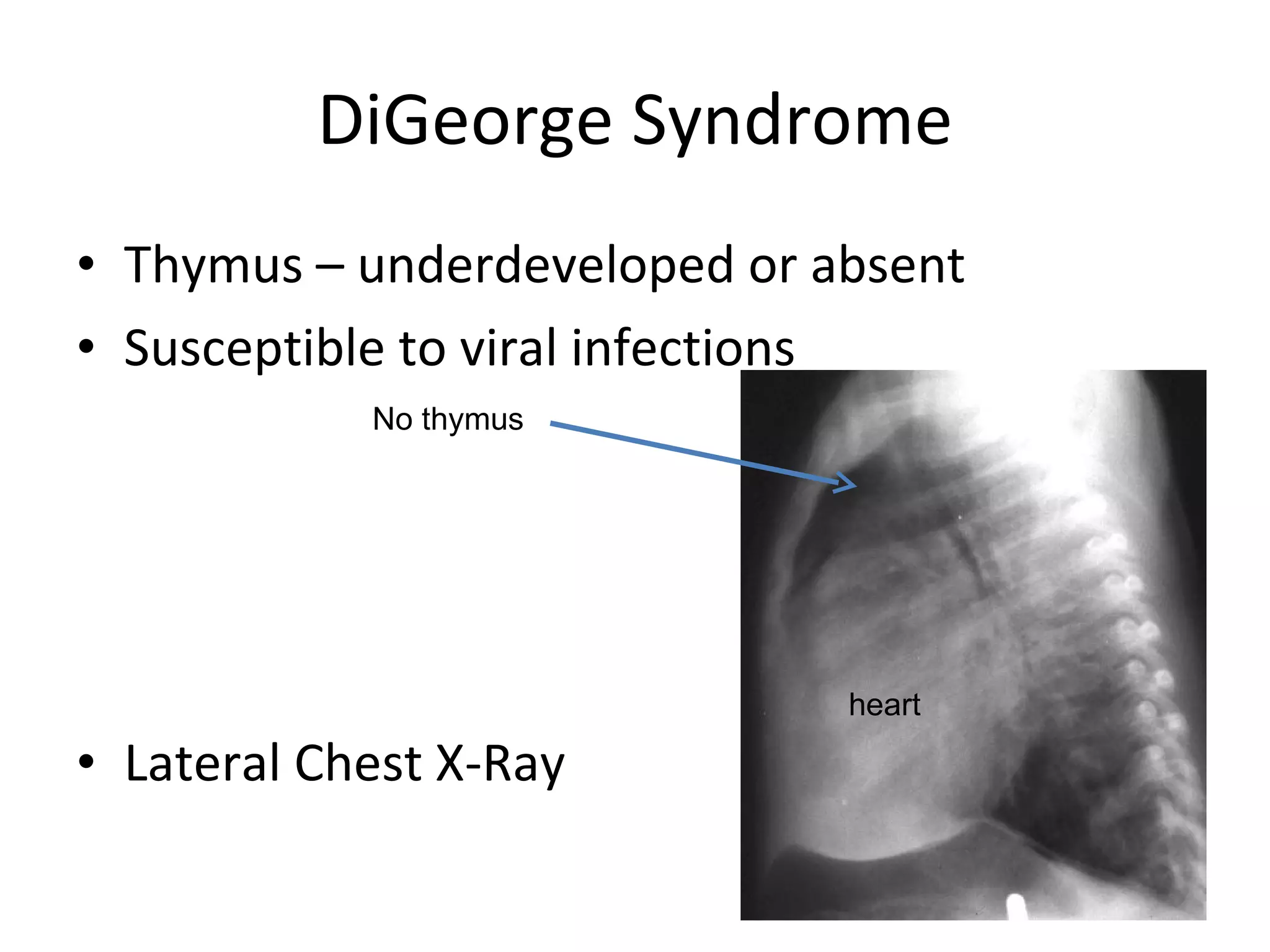 Diseases Of The Immune System (2) | PPT