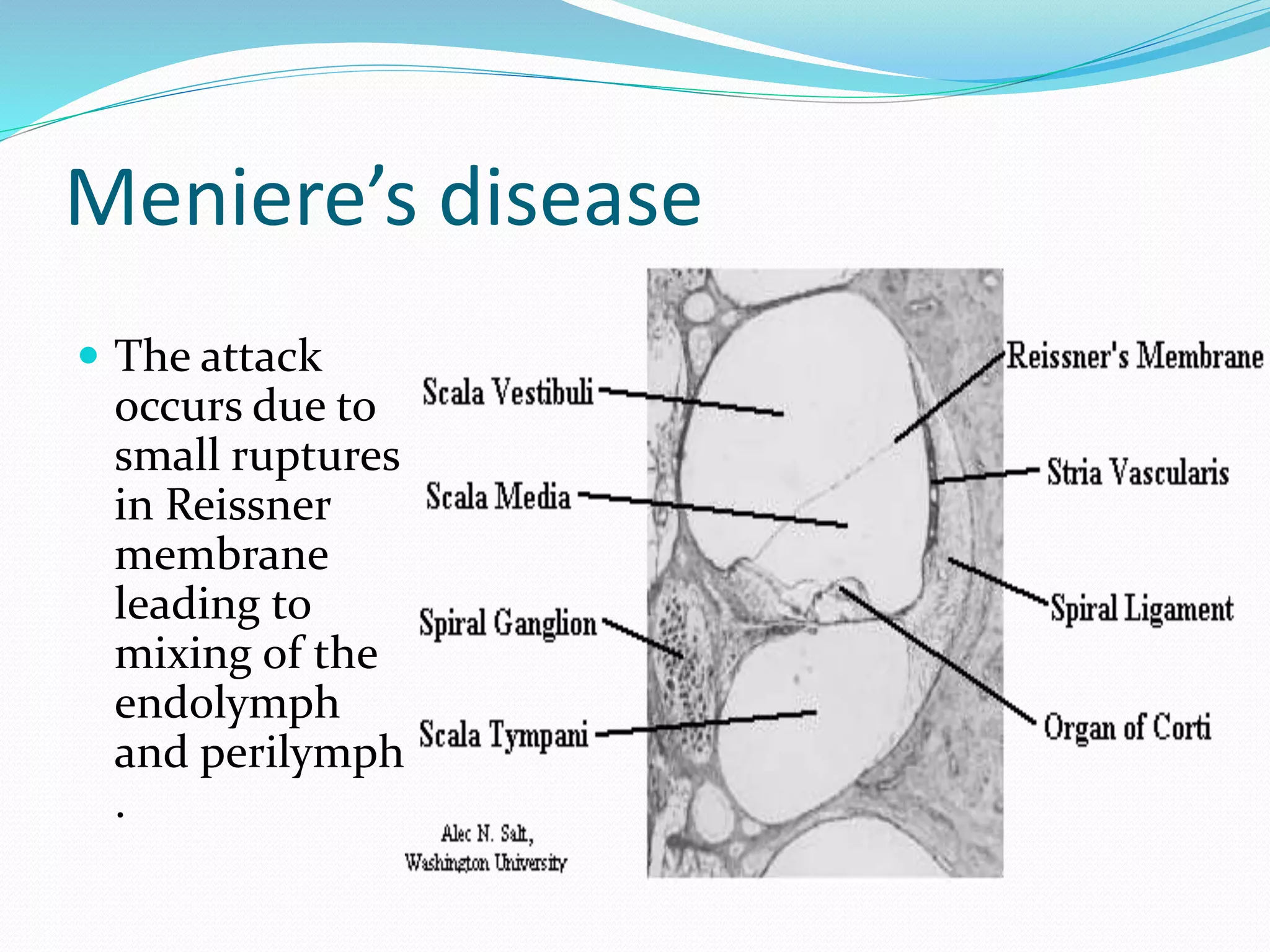 Diseases of the inner ear | PPTX