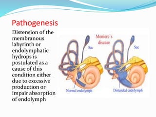 Diseases of the inner ear | PPTX
