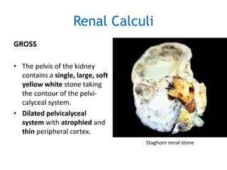 Diseases of the kidney | PPTX