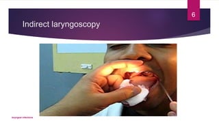 Diseases of the larynx | PPTX