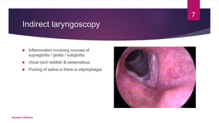 Diseases of the larynx | PPTX