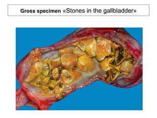 Diseases of the liver - pancreas- and gallbladder -1- 2.ppt
