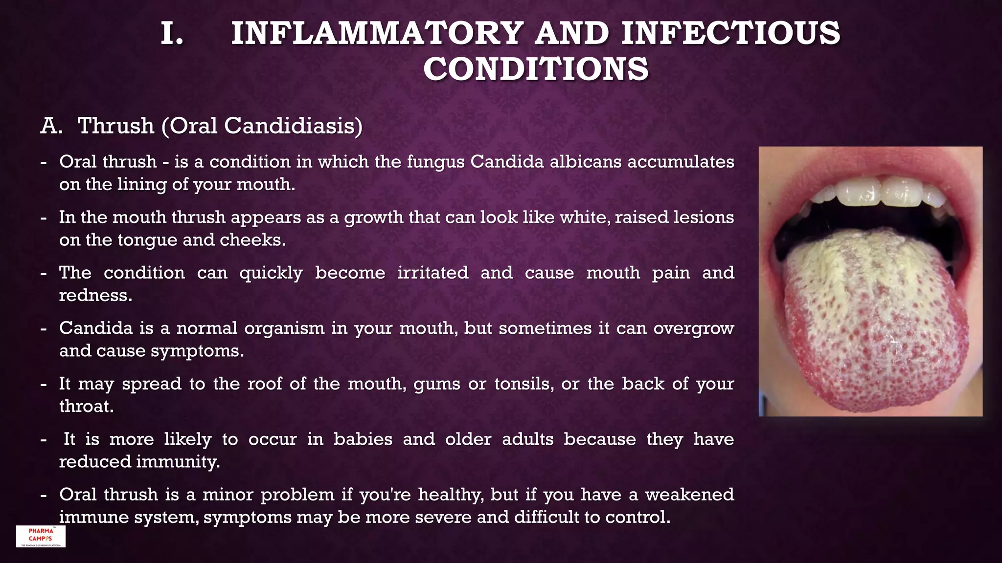 Diseases of the mouth | PDF
