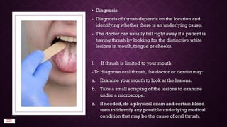 Diseases of the mouth | PPT