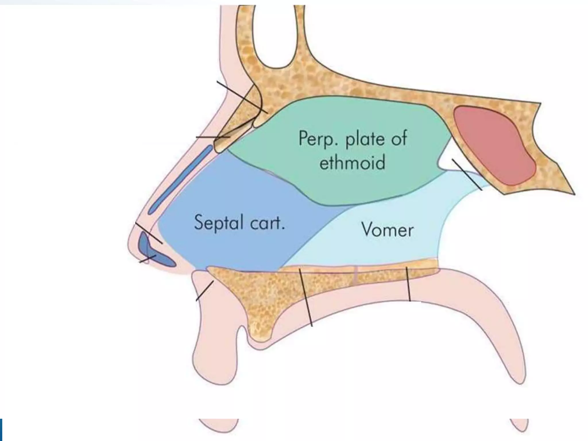 Diseases of the nasal septum | PPTX