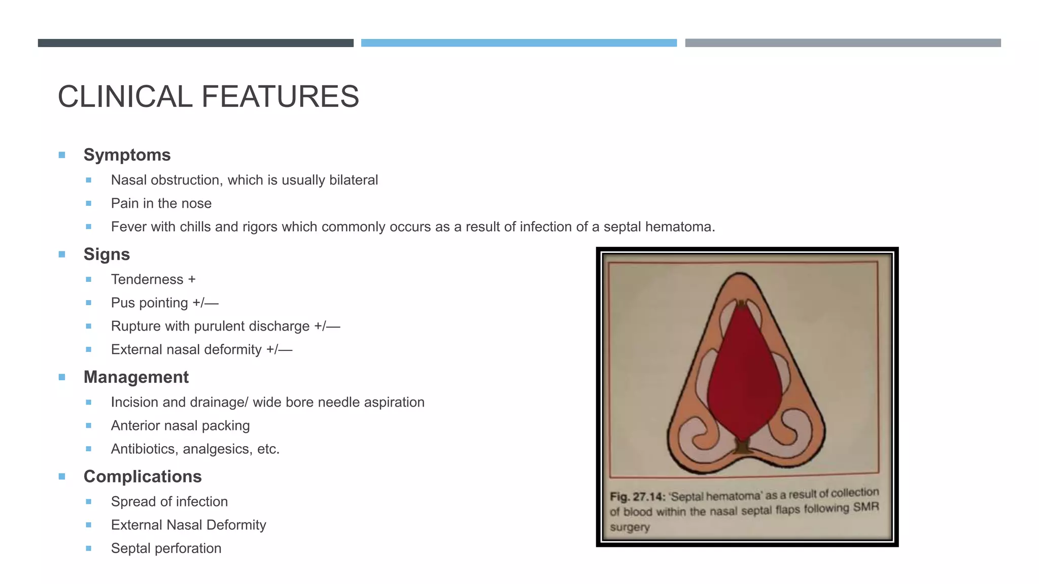 Diseases of the nasal septum | PPTX