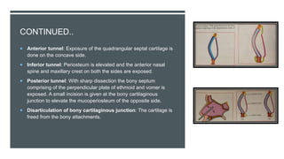 Diseases of the nasal septum | PPTX