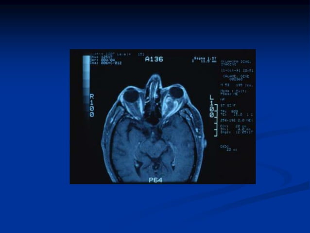 Diseases of the Orbit | PPT | Eye and Vision Conditions | Diseases and ...