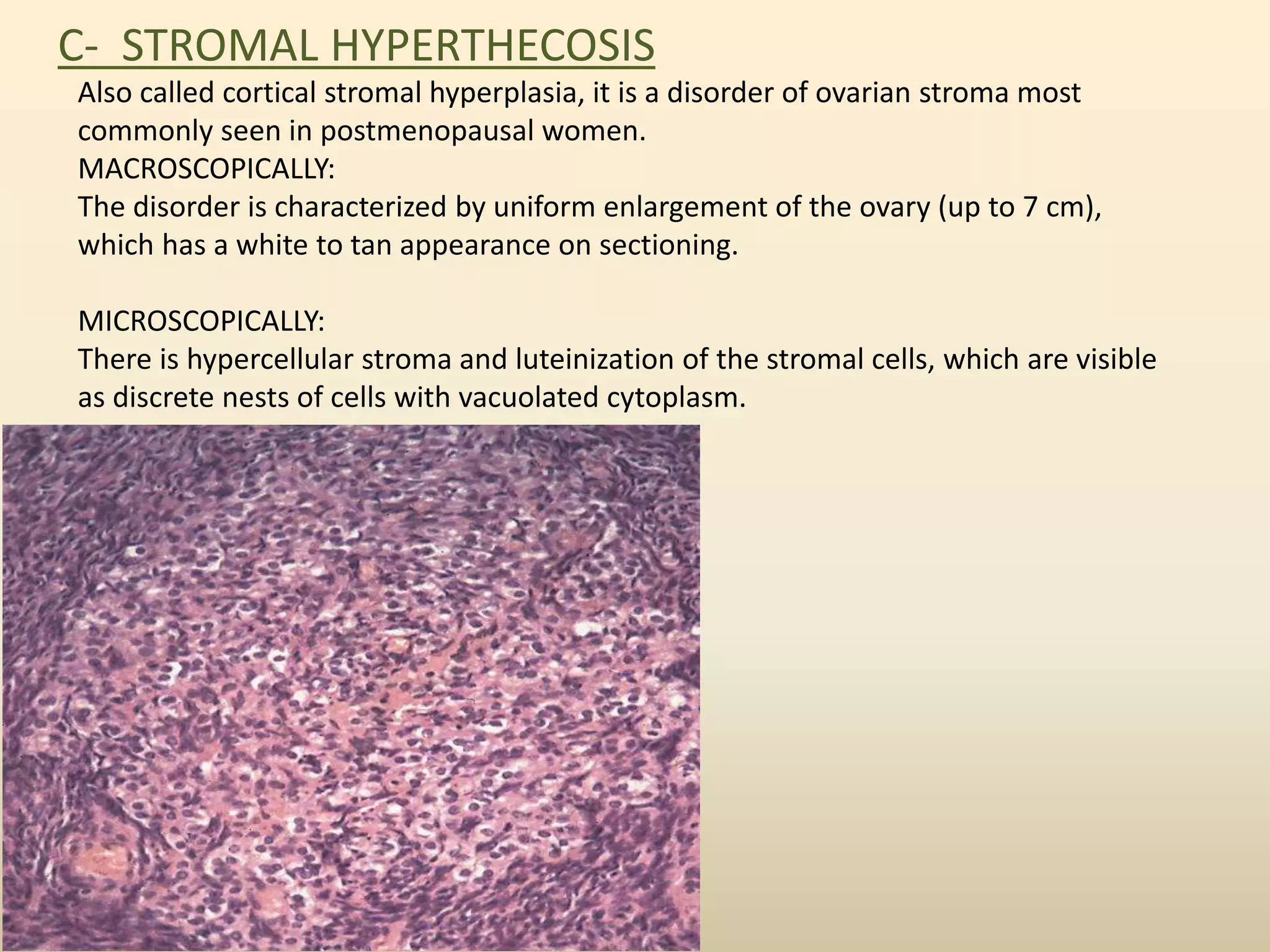 Diseases of the ovaries | PPTX