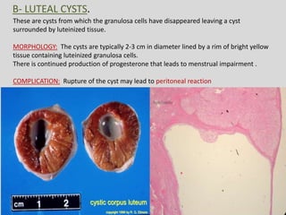 Diseases of the ovaries | PPTX