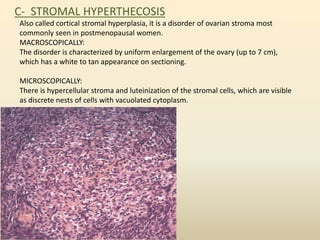 Diseases of the ovaries | PPTX