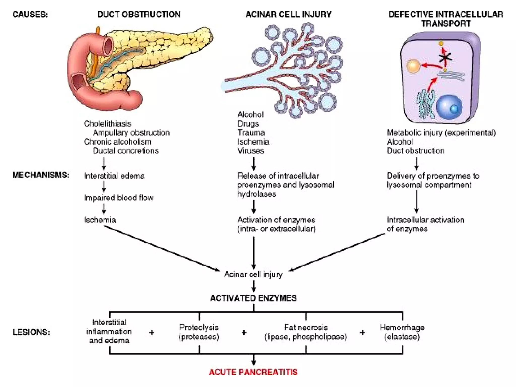 Diseases of the pancreas csbrp | PPT