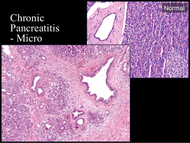 Diseases of the pancreas csbrp