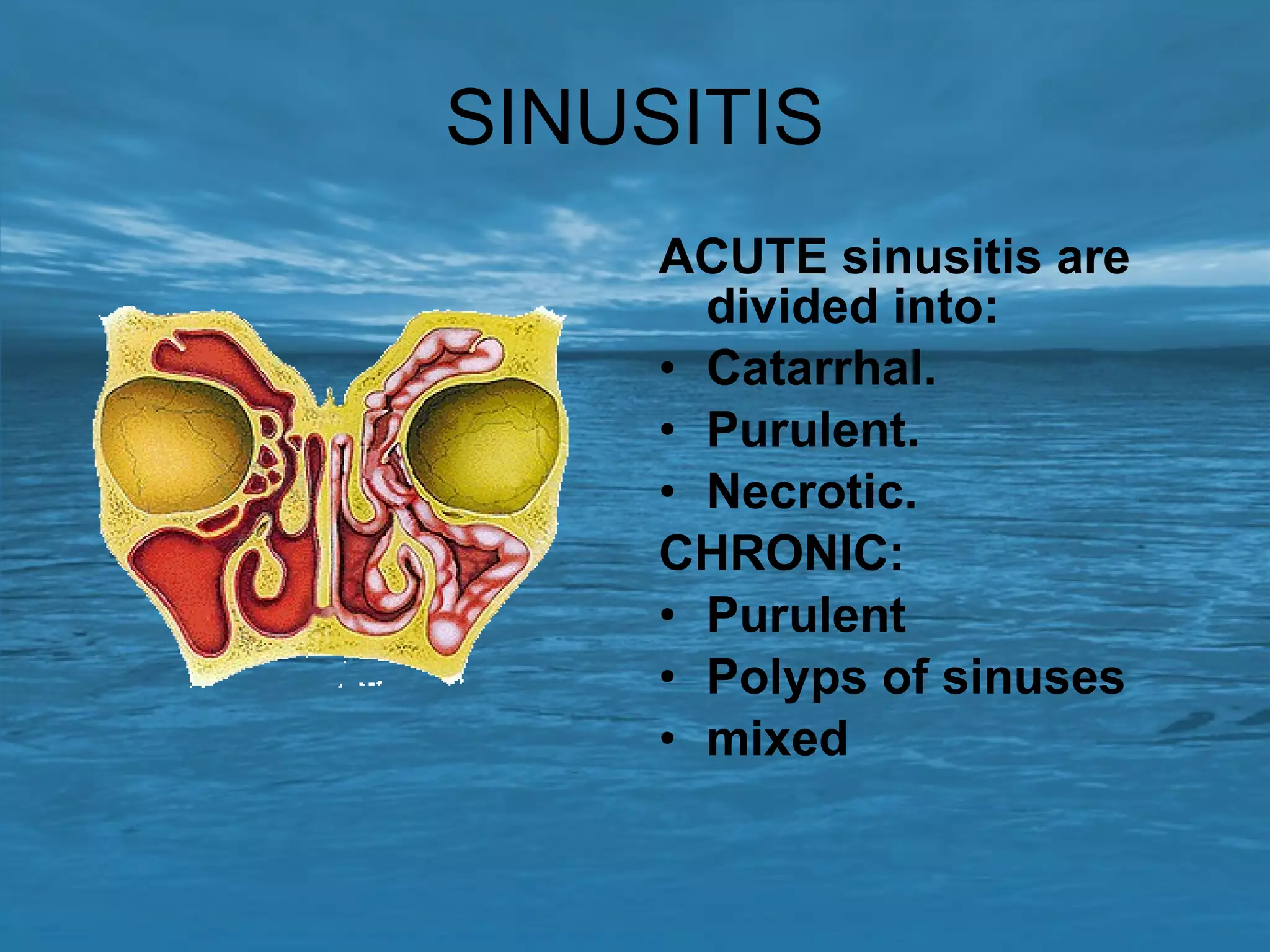Diseases of the paranasal sinuses. | PPT