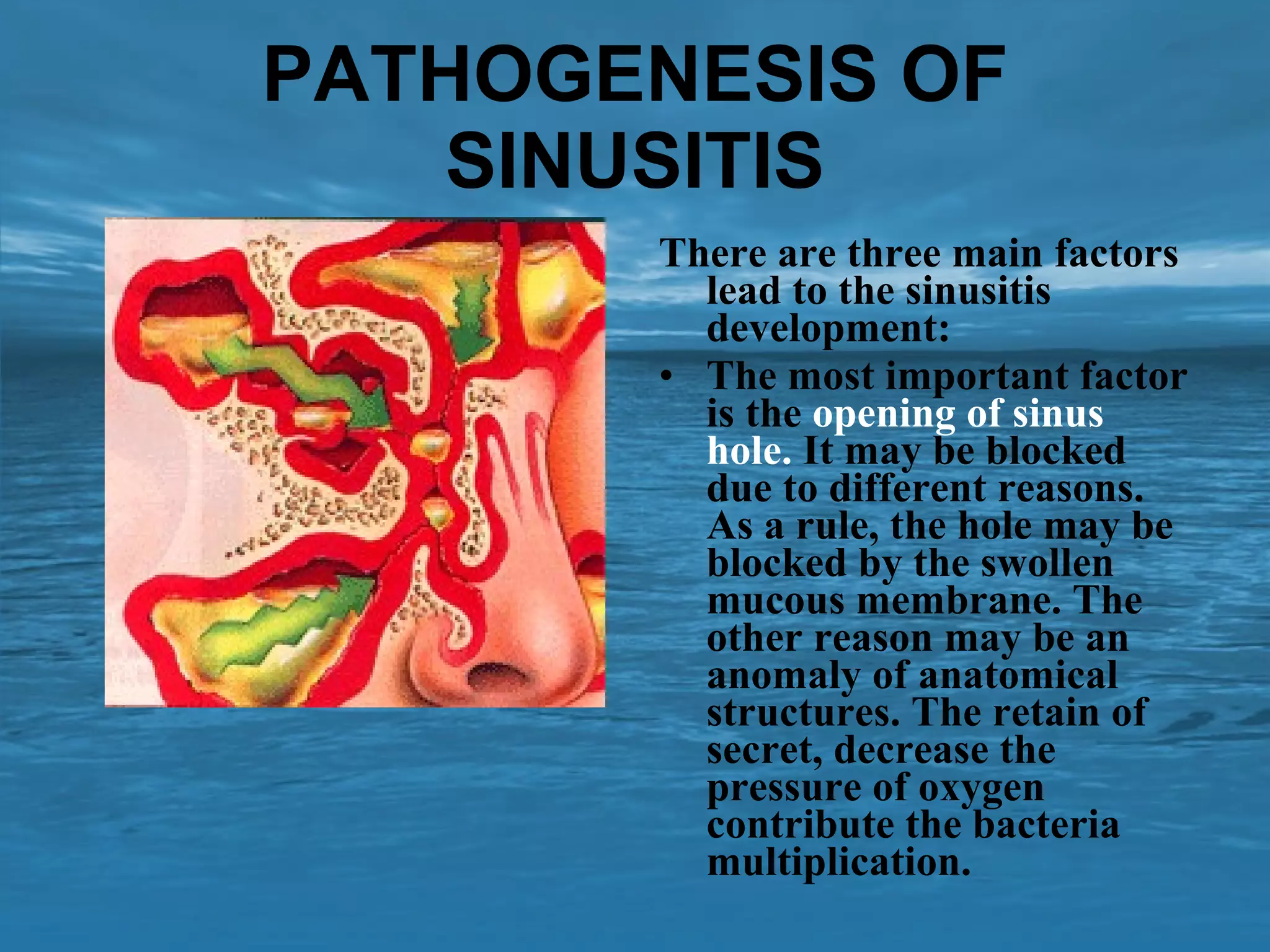 Diseases of the paranasal sinuses. | PPT