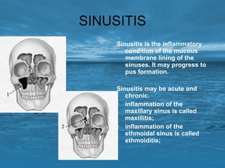 Diseases of the paranasal sinuses. | PPT