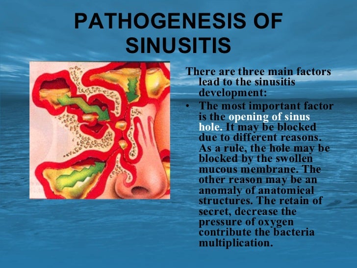 Diseases of the paranasal sinuses.