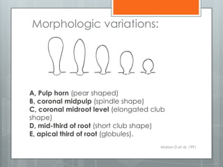 Diseases of the pulp:Part 1- Development, Physiology, Histology of ...