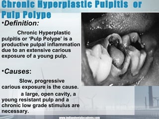 Chronic Hyperplastic Pulpitis