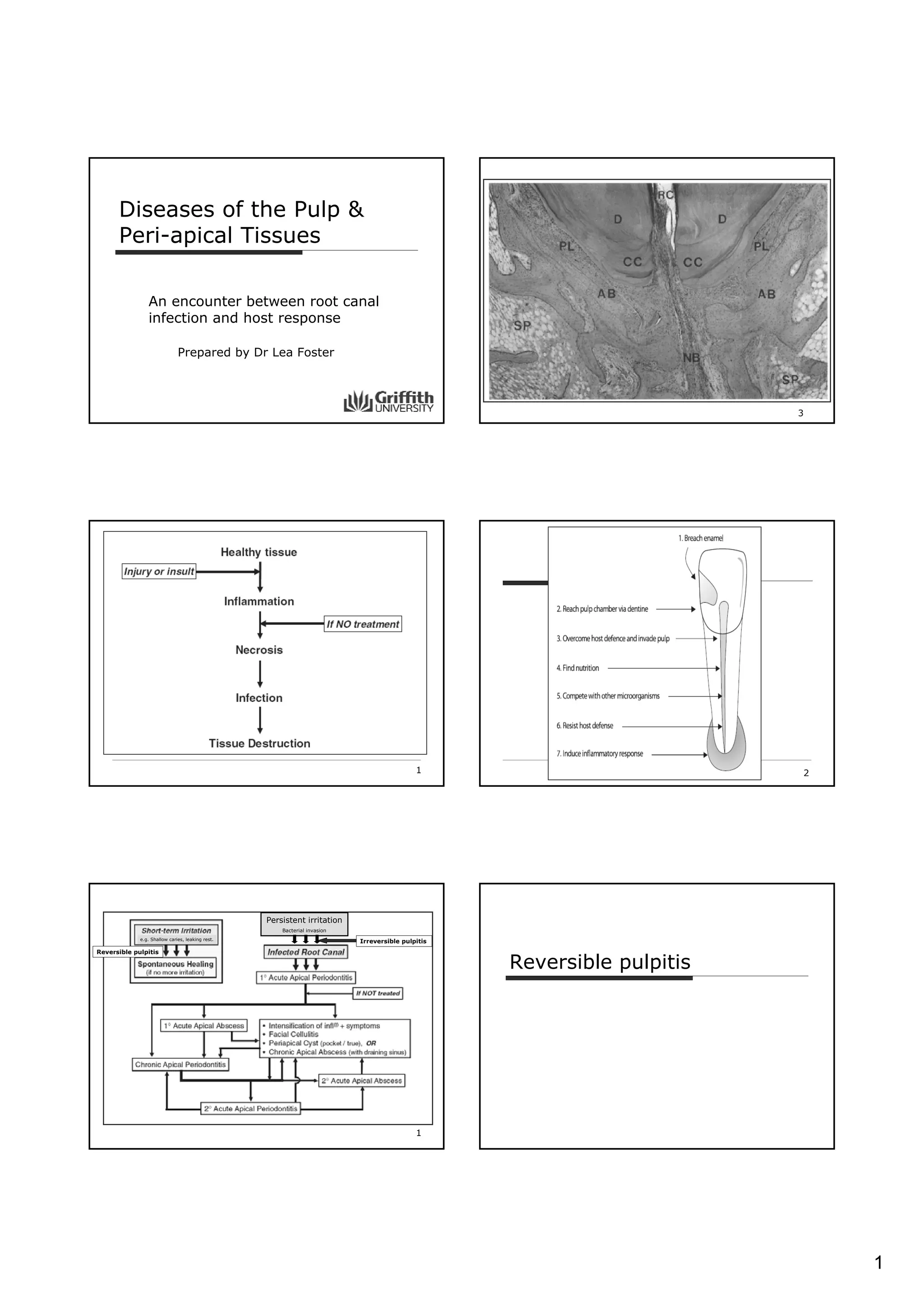 Diseases of the pulp & peri apical tissues 2009 | PDF