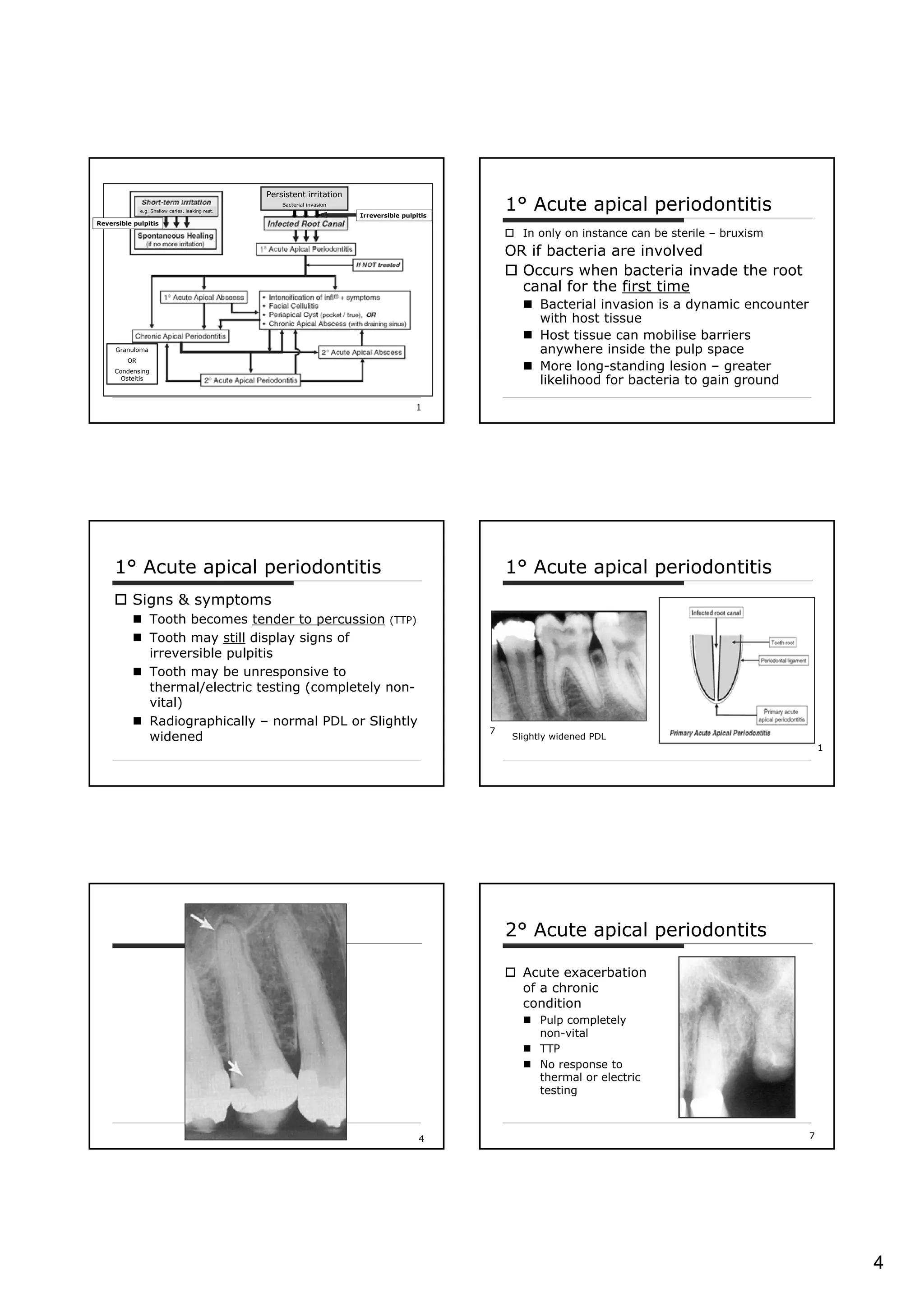Diseases of the pulp & peri apical tissues 2009 | PDF