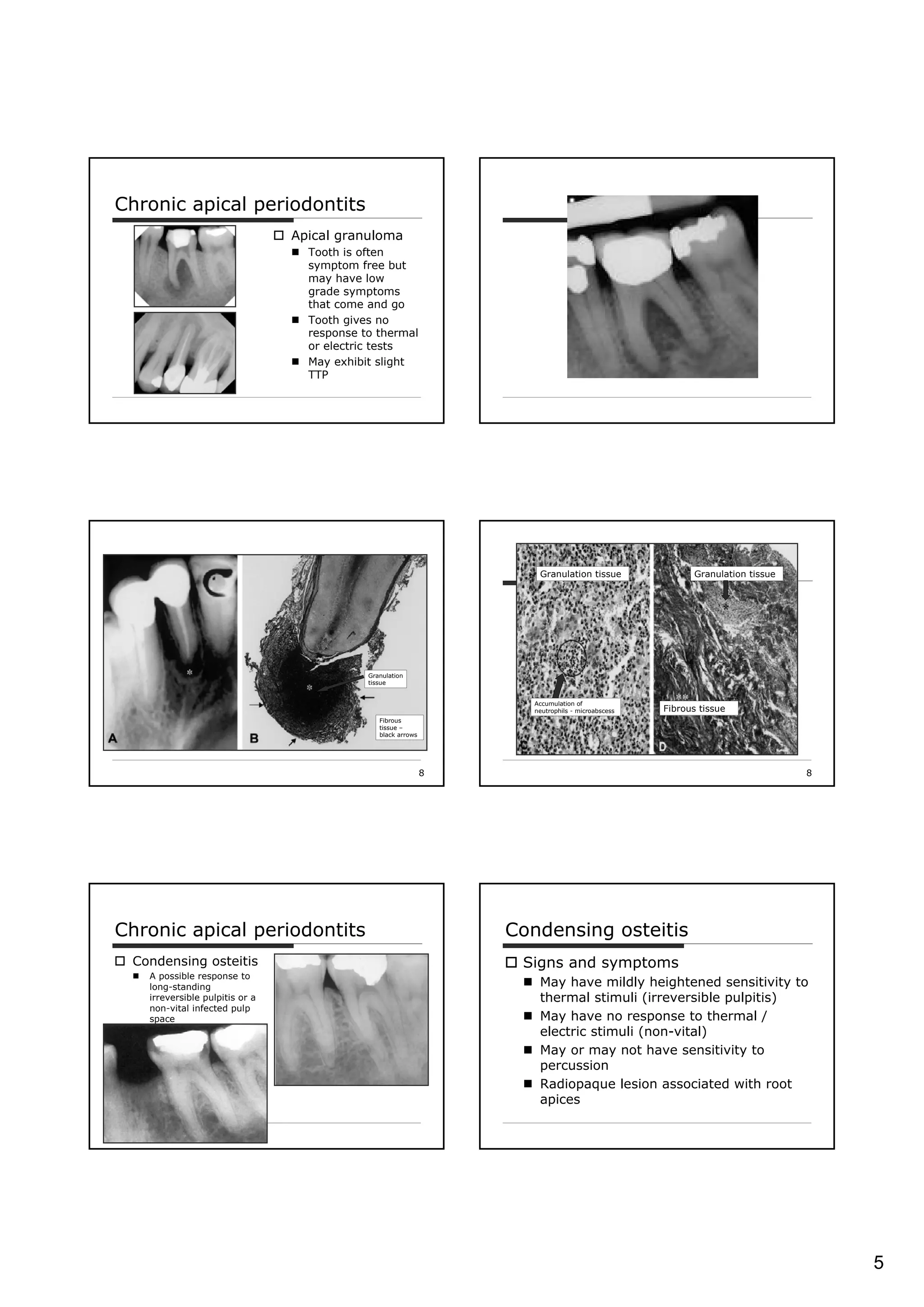 Diseases of the pulp & peri apical tissues 2009 | PDF
