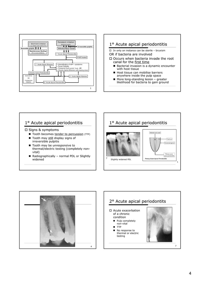 Diseases of the pulp & peri apical tissues 2009 | PDF | Dental Health ...