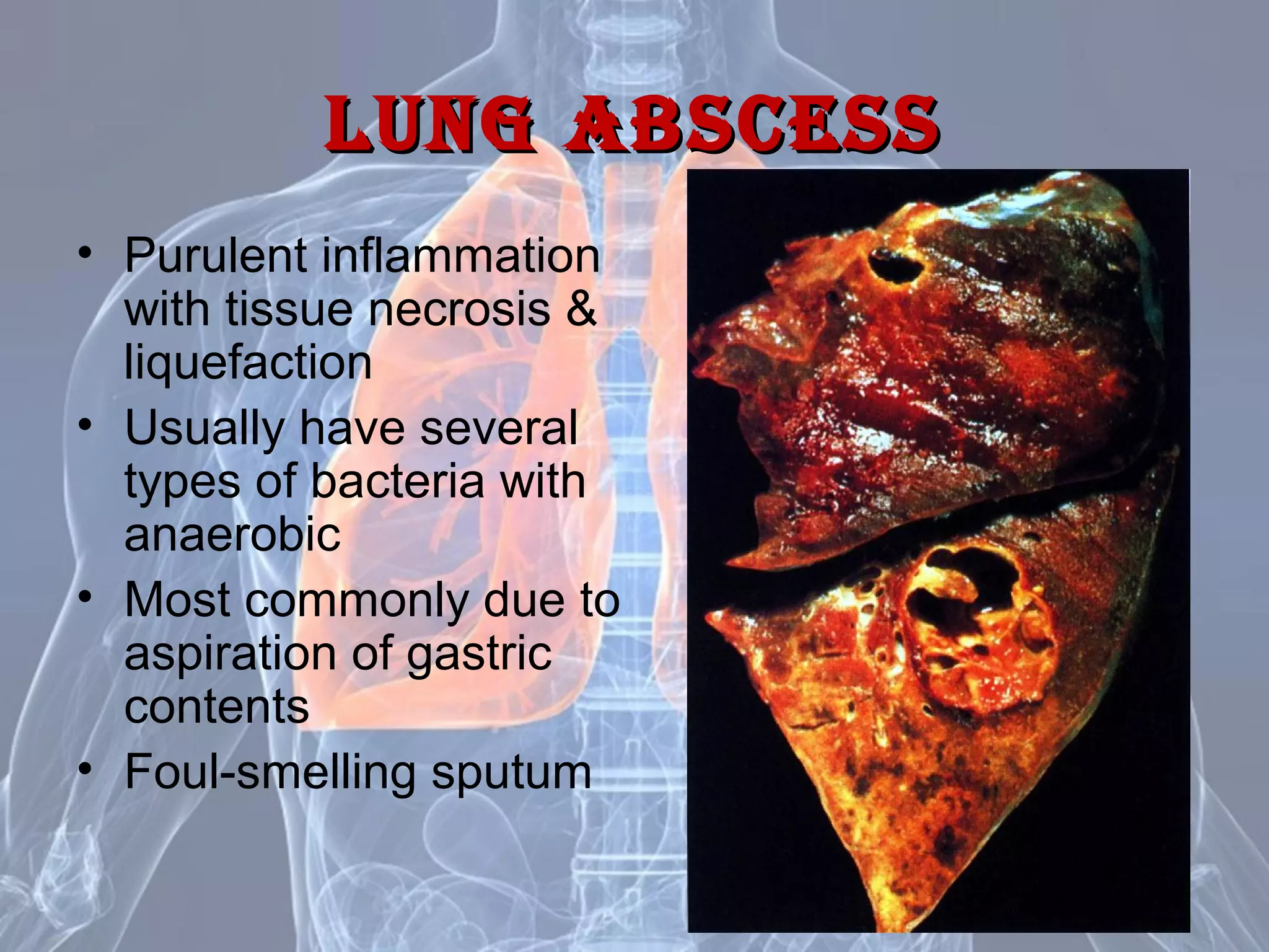 Diseases of the respiratory system | PPT