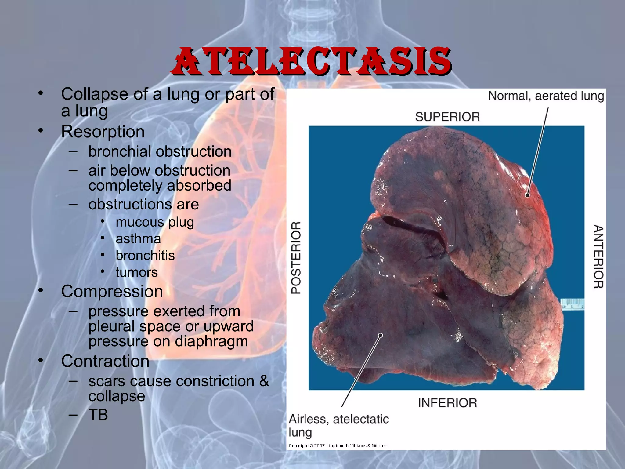Diseases of the respiratory system | PPT