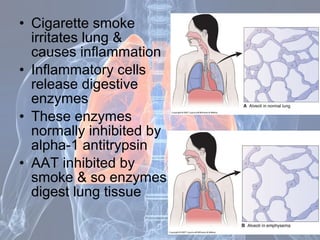 Diseases of the respiratory system | PPT
