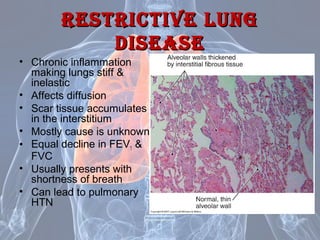 Diseases of the respiratory system | PPT
