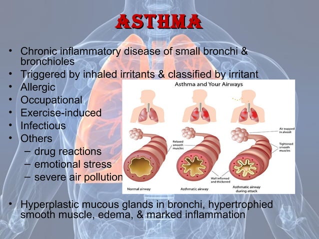 Diseases of the respiratory system | PPT