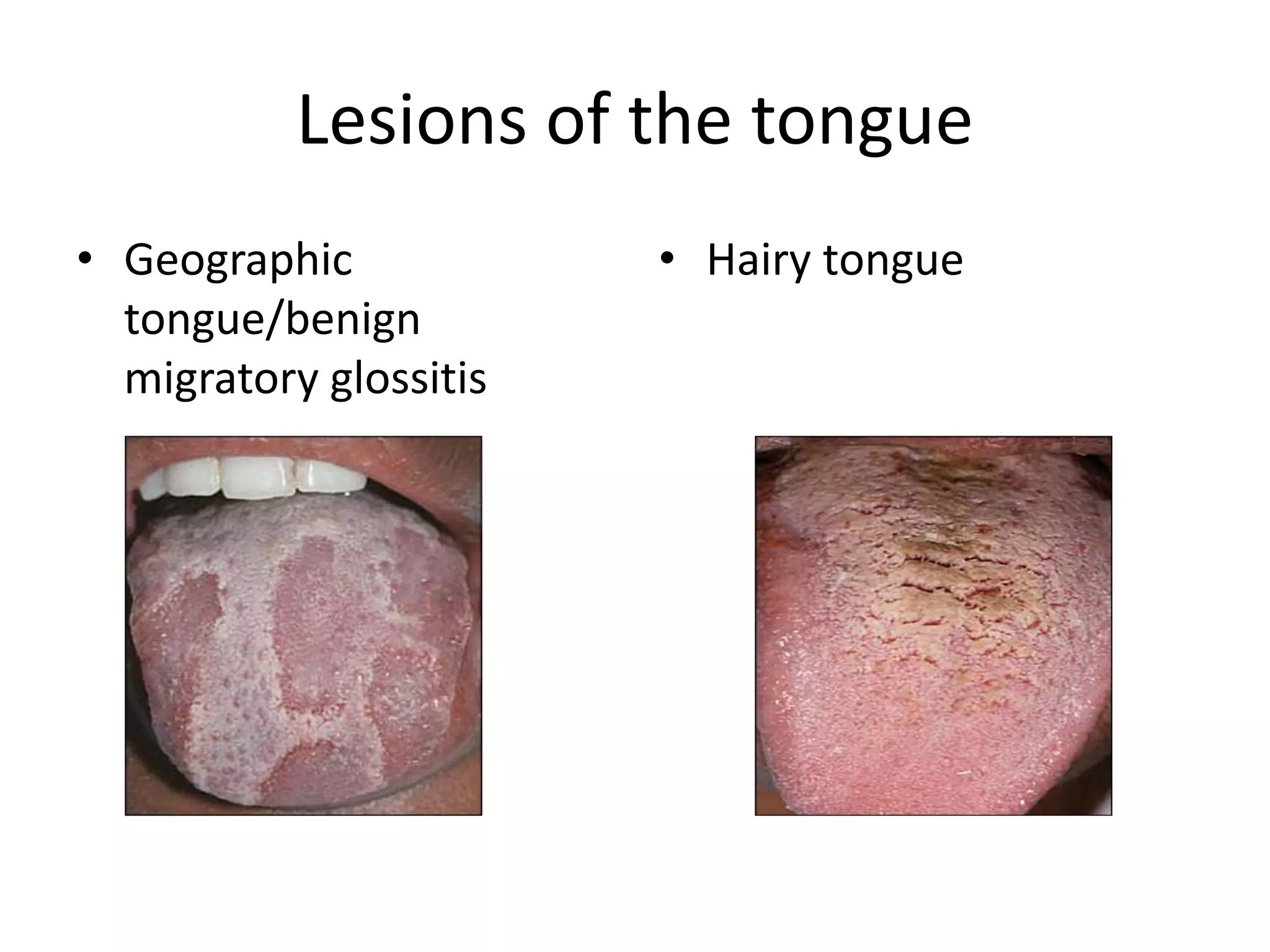 Diseases of the throat by Dr. Kavitha Ashok Kumar MSU Malaysia | PDF