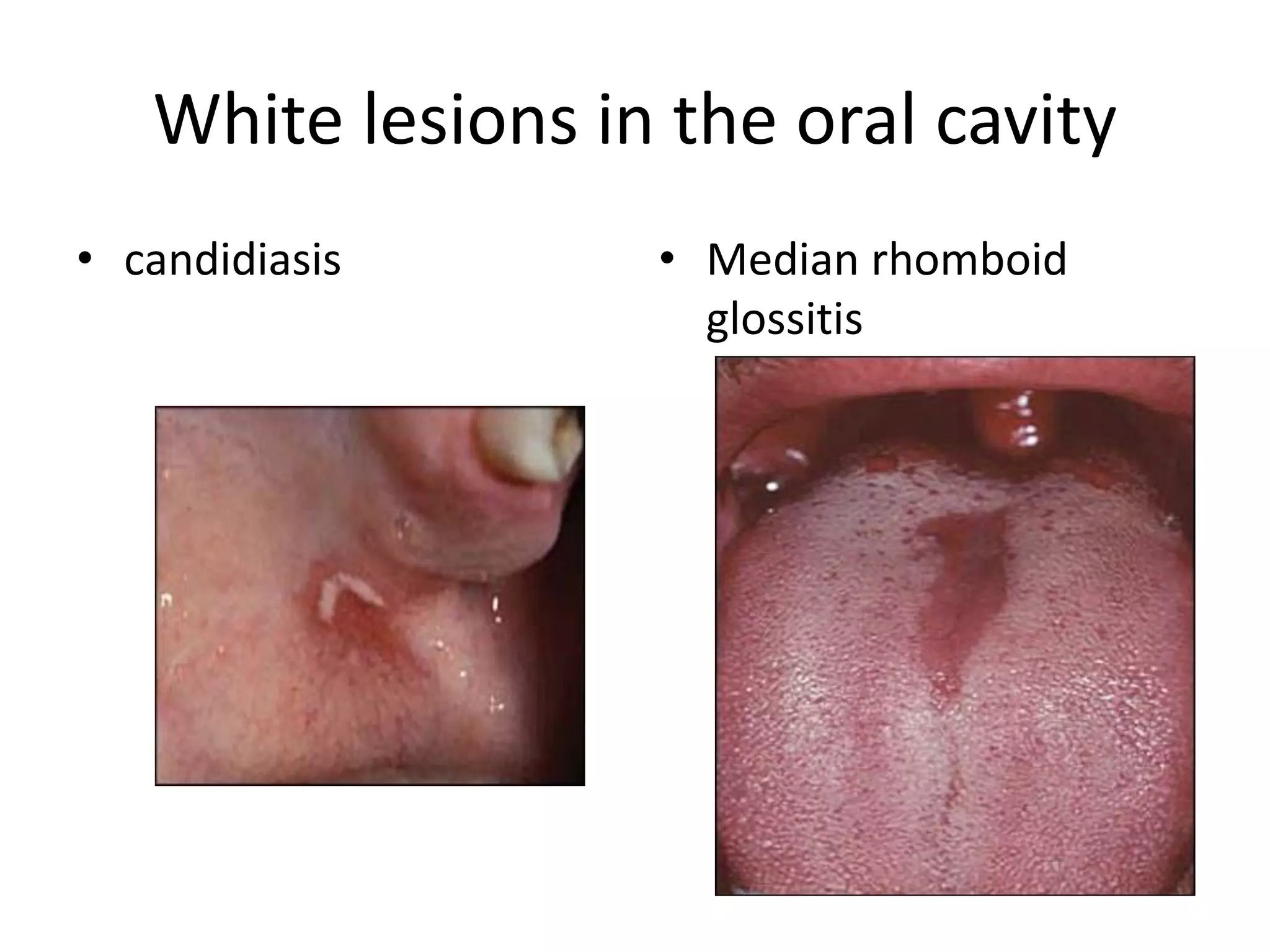 Diseases of the throat by Dr. Kavitha Ashok Kumar MSU Malaysia | PDF