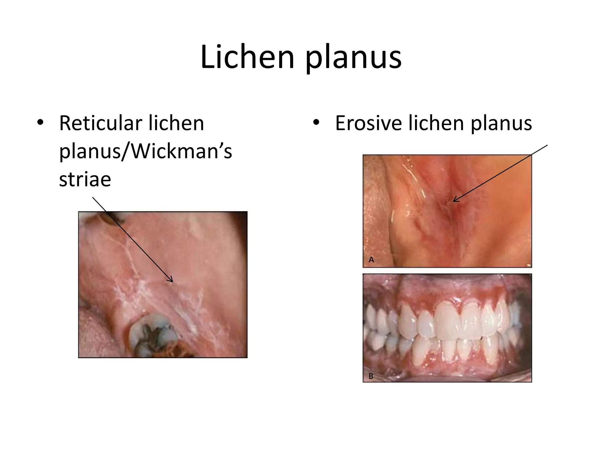 Diseases of the throat by Dr. Kavitha Ashok Kumar MSU Malaysia | PDF