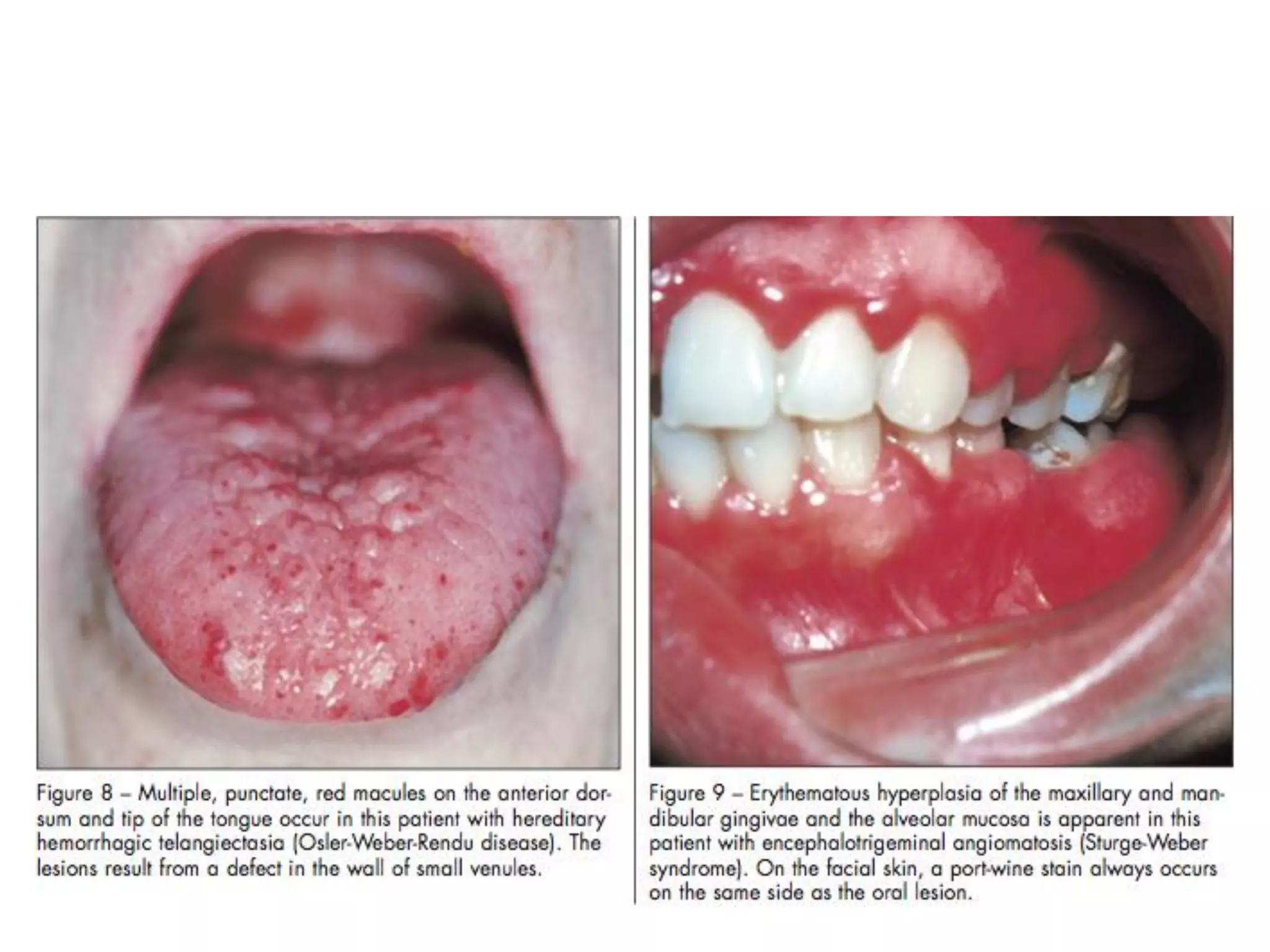 Diseases of the throat by Dr. Kavitha Ashok Kumar MSU Malaysia | PDF