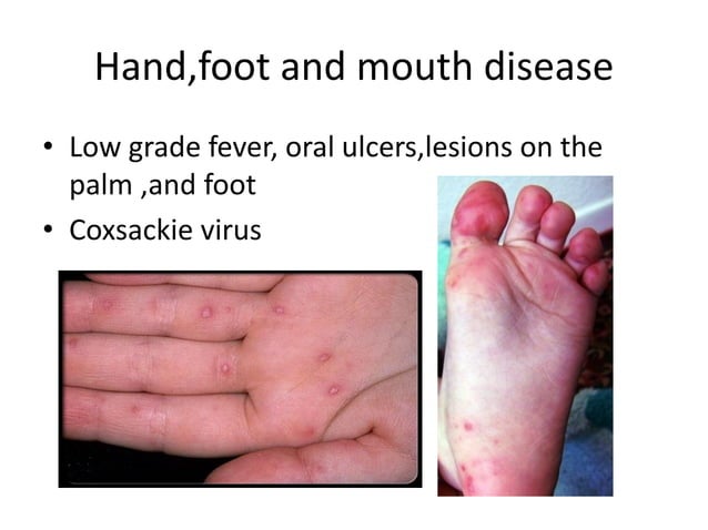 Diseases of the throat by Dr. Kavitha Ashok Kumar MSU Malaysia | PDF | Ear, Nose and Throat ...