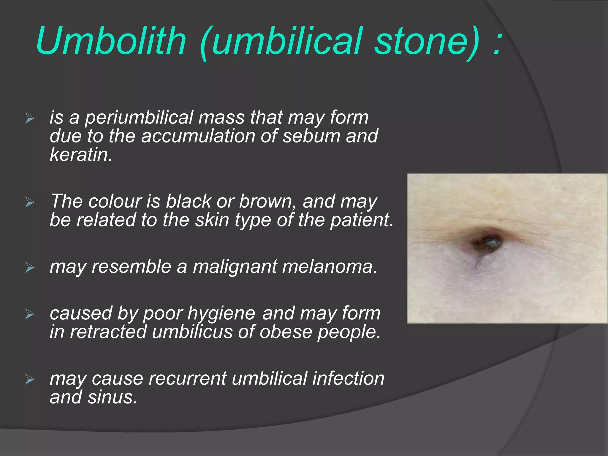 DISEASES OF THE UMBILICUS.pptx