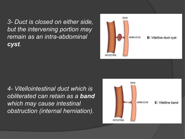 DISEASES OF THE UMBILICUS.pptx