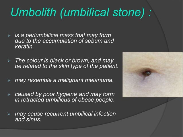 DISEASES OF THE UMBILICUS.pptx