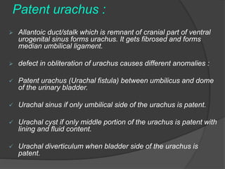 DISEASES OF THE UMBILICUS.pptx