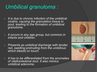 DISEASES OF THE UMBILICUS.pptx