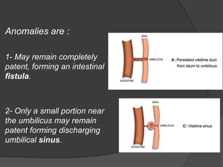 DISEASES OF THE UMBILICUS.pptx