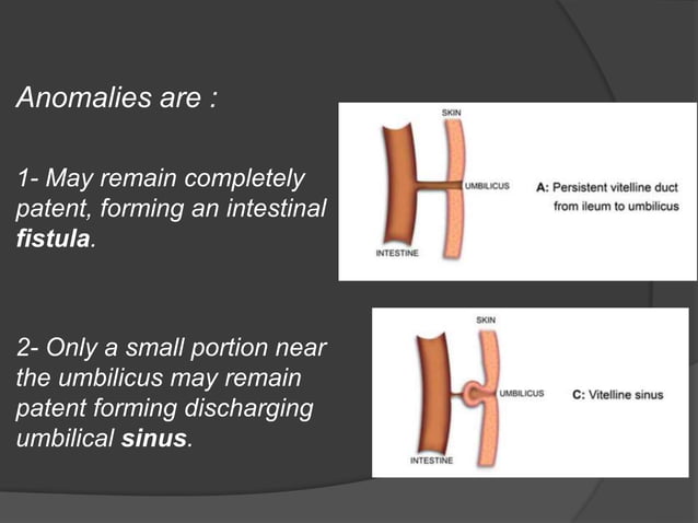 DISEASES OF THE UMBILICUS.pptx
