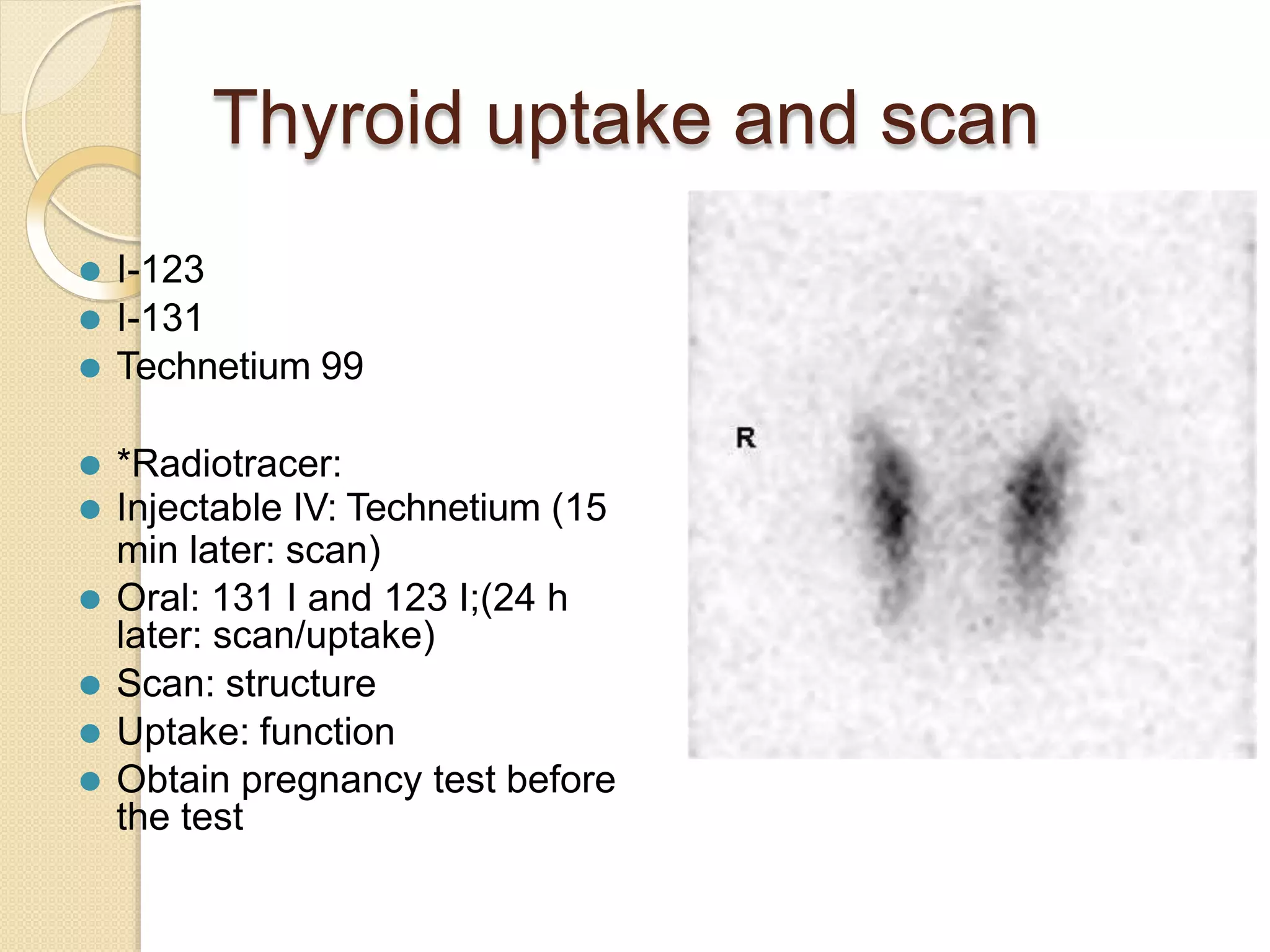 Diseases of thyroid gland.pptx