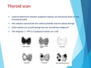 Diseases of thyroid gland.pptx