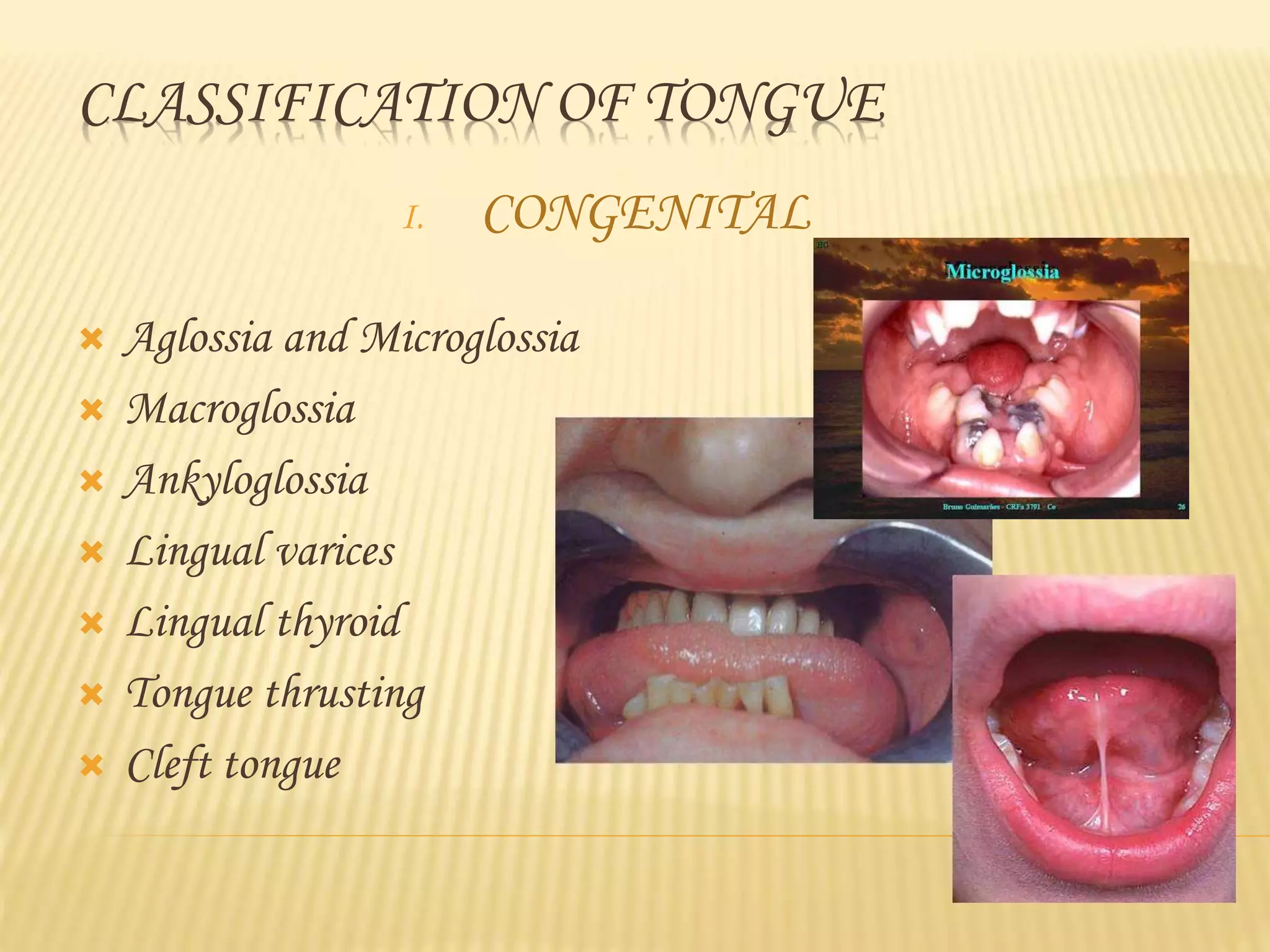 Diseases of tongue | PPTX