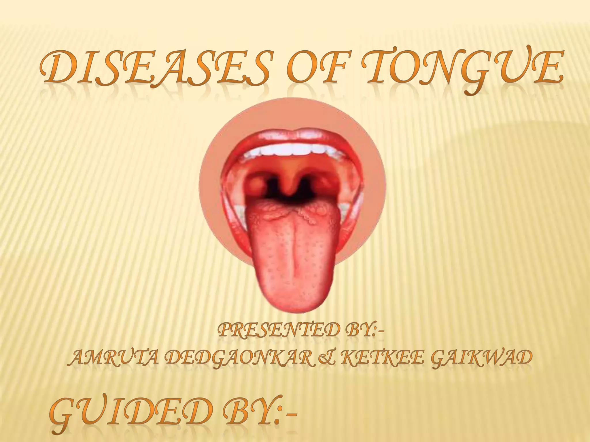 Diseases of tongue | PPT