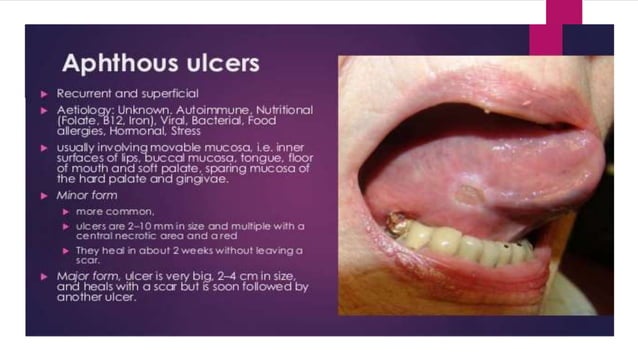 Diseases of tongue | PPTX | Ear, Nose and Throat Conditions | Diseases ...